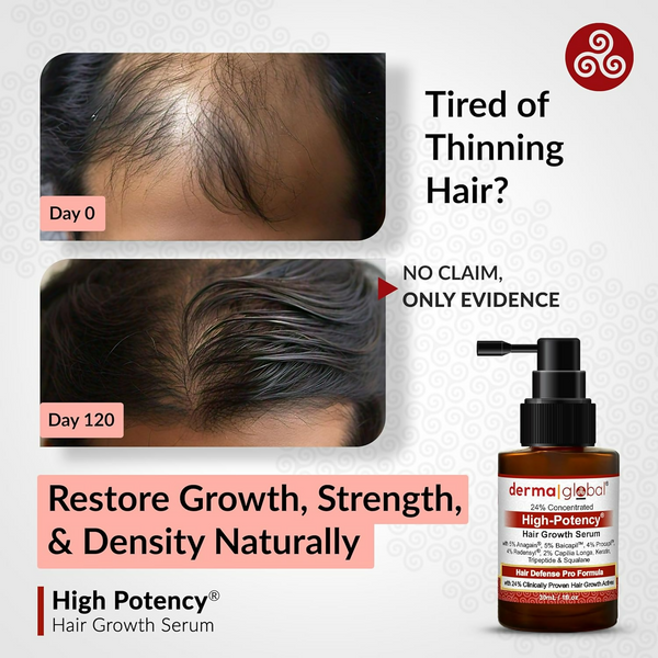 Buy Derma Global High Potency Hair Growth Serum Online at Best Price ...